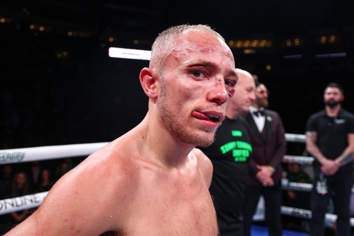 Sunny Edwards: I'll Be Back, Just a Bit Disappointed My Eye Went So ...